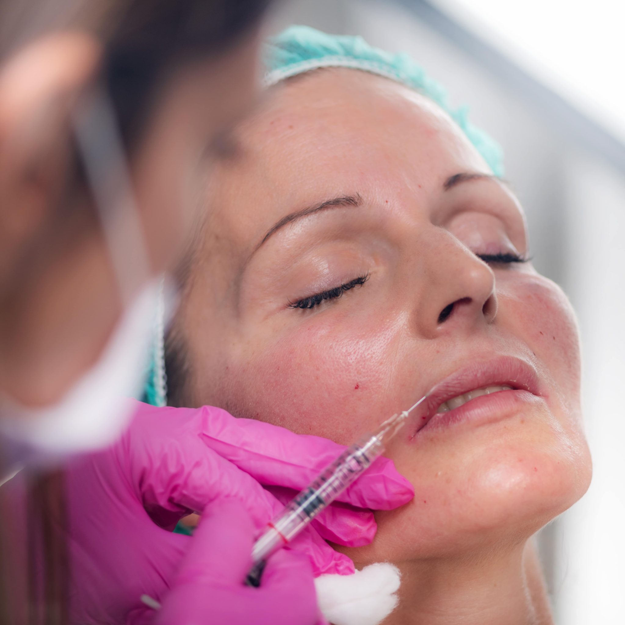 Fillers Ottawa | Dermal Filler Treatments at GlowUp MediSpa